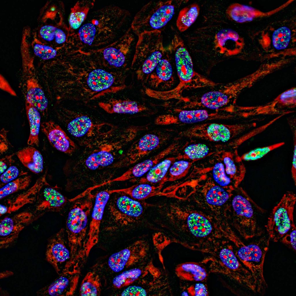 Life sciences - Spark Lasers